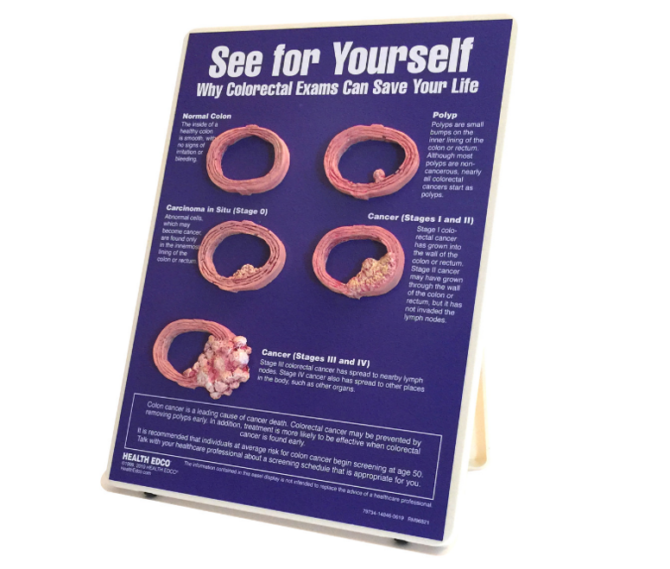 Lou-Wheeze – model porównujący zdrowe płuca z płucami palacza - Simedu
